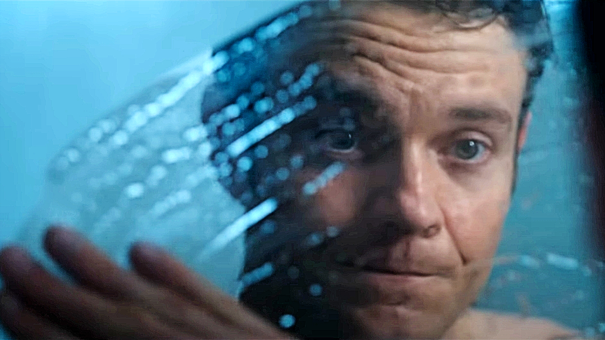 'Novocaine’ Review: Everybody Hurts Sometimes, But Not Everybody Feels It - Sometimes